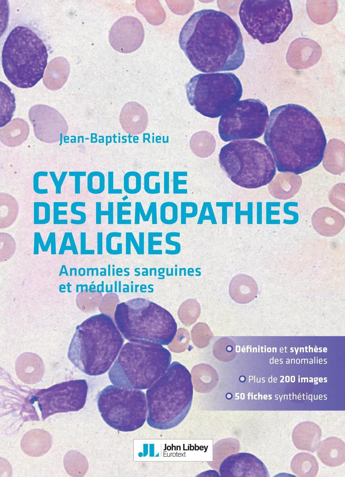 Cytologie des hémopathies malignes - Anomalies sanguines et médullaires ...